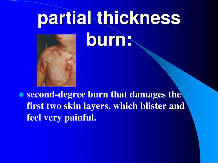 PPT - abandonment: PowerPoint Presentation - ID:5303536