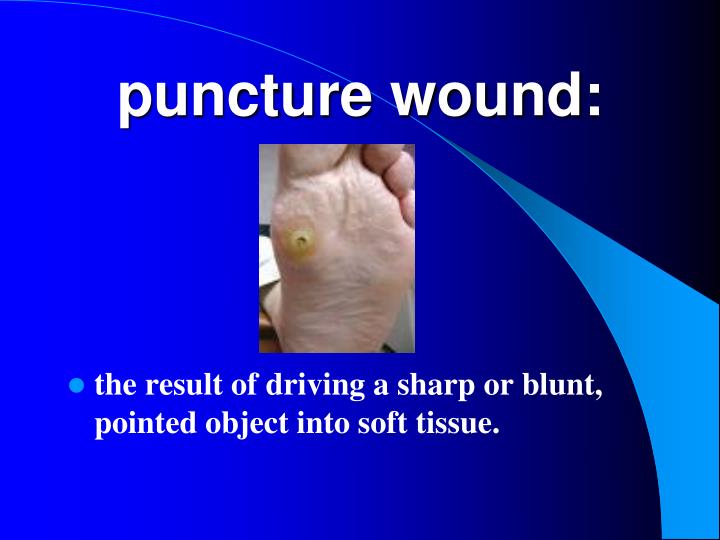 PPT - abandonment: PowerPoint Presentation - ID:5303536