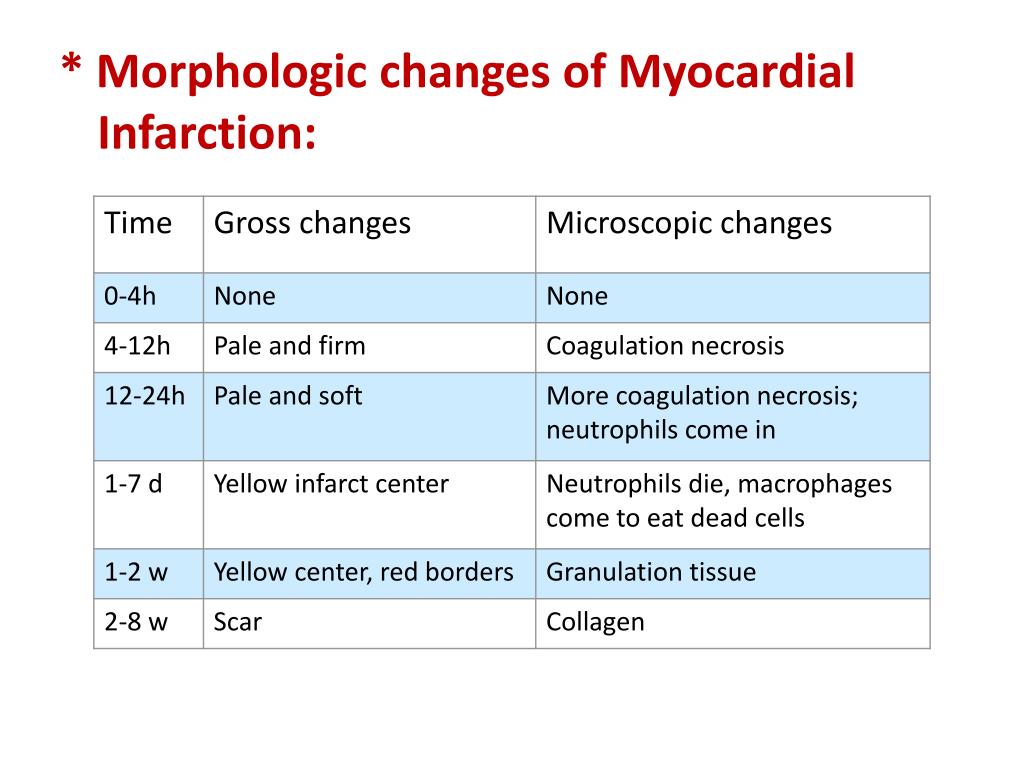 PPT - Myocardial Infarction PowerPoint Presentation, free download - ID ... PPT - Myocardial Infarction PowerPoint Presentation, free download - ID ...