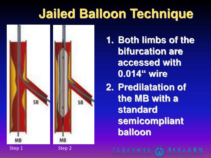PPT - Side Branch Protection: Jailed Balloon Technique “ 拘禁 ” 球囊分支保护技术 ...