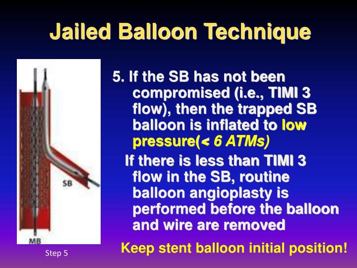 PPT - Side Branch Protection: Jailed Balloon Technique “ 拘禁 ” 球囊分支保护技术 ...
