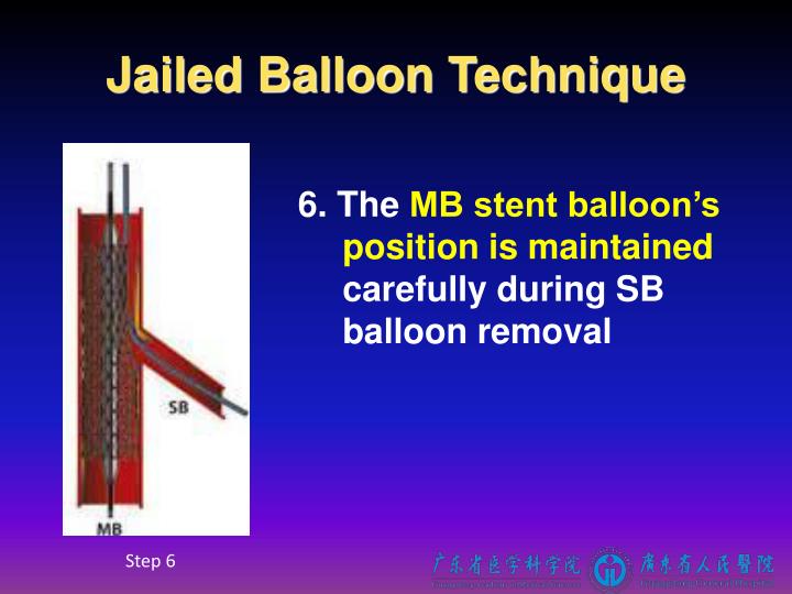 PPT - Side Branch Protection: Jailed Balloon Technique “ 拘禁 ” 球囊分支保护技术 ...