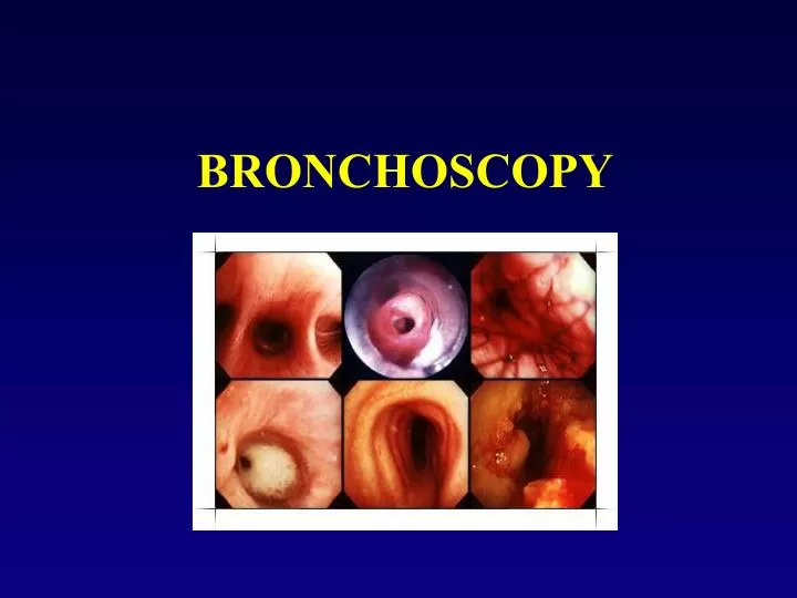 PPT - BRONCHOSCOPY PowerPoint Presentation, free download - ID:5317592