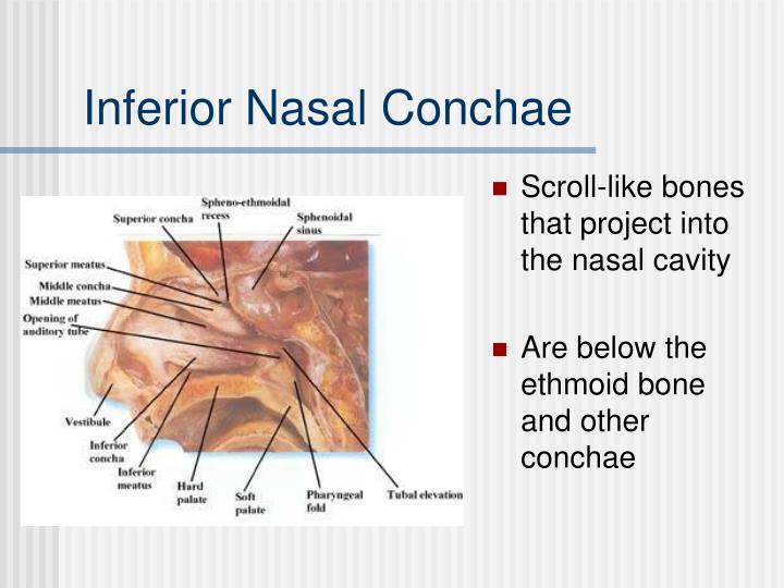 PPT - The Axial Skeleton PowerPoint Presentation - ID:5318624