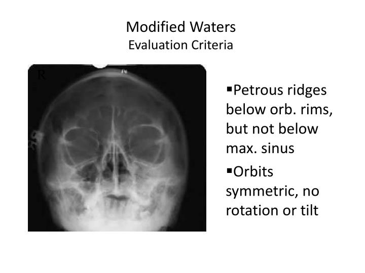 PPT - What is an Orbit? 4 5 2014 PowerPoint Presentation - ID:5318635
