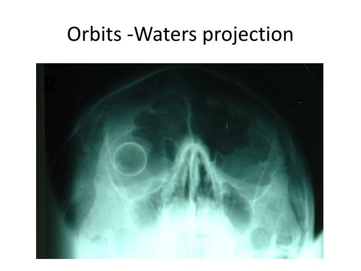 PPT - What is an Orbit? 4 5 2014 PowerPoint Presentation - ID:5318635