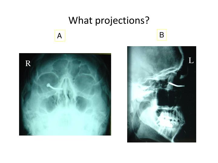 PPT - What is an Orbit? 4 5 2014 PowerPoint Presentation - ID:5318635