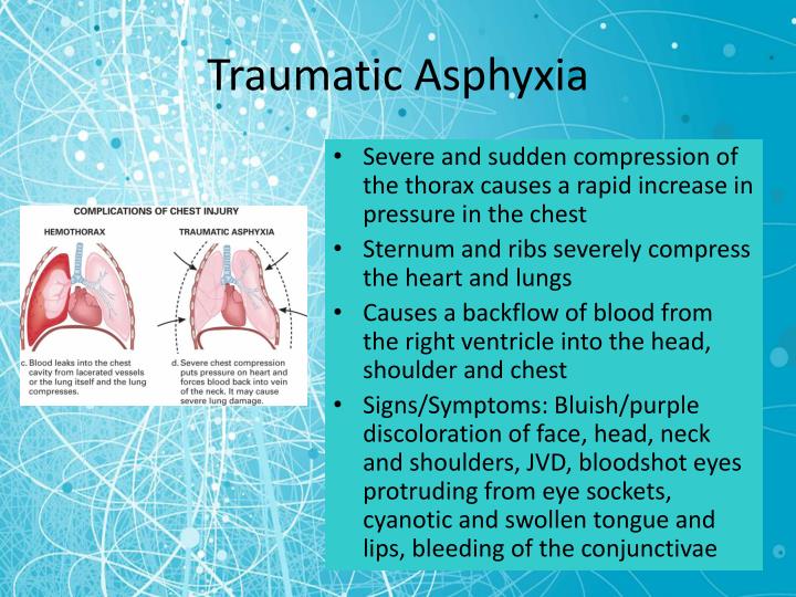 PPT - Chest Trauma PowerPoint Presentation - ID:5319182
