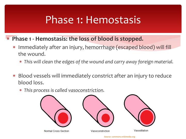 PPT - Wound Repair PowerPoint Presentation - ID:5323746