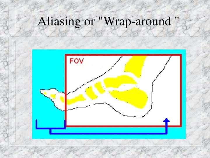 PPT - MRI Artifacts PowerPoint Presentation - ID:5323805