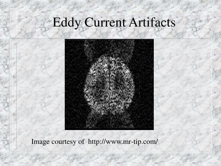 PPT - MRI Artifacts PowerPoint Presentation - ID:5323805