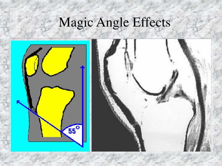 PPT - MRI Artifacts PowerPoint Presentation - ID:5323805