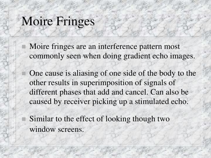 PPT - MRI Artifacts PowerPoint Presentation - ID:5323805