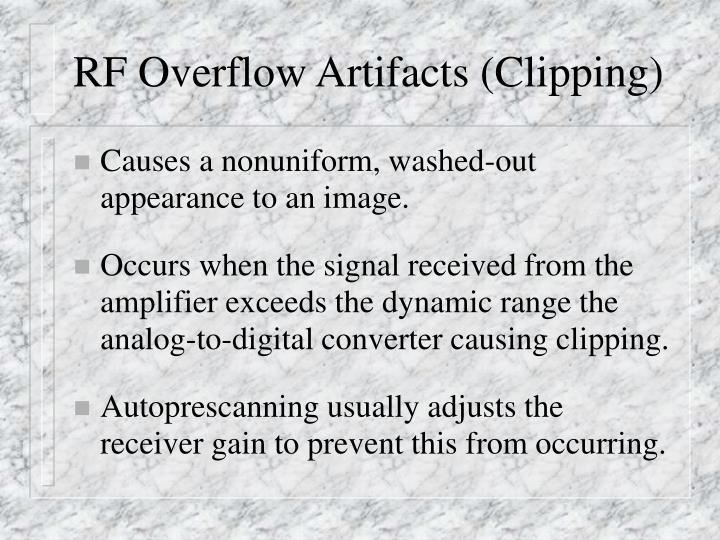 PPT - MRI Artifacts PowerPoint Presentation - ID:5323805