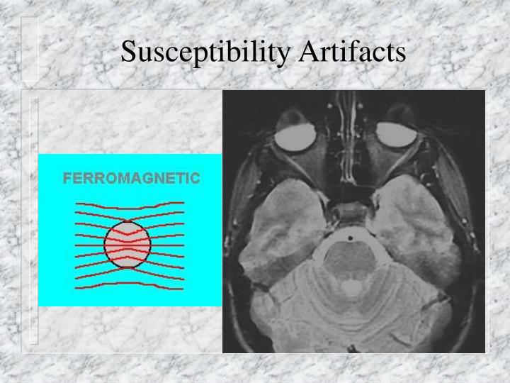 PPT - MRI Artifacts PowerPoint Presentation - ID:5323805
