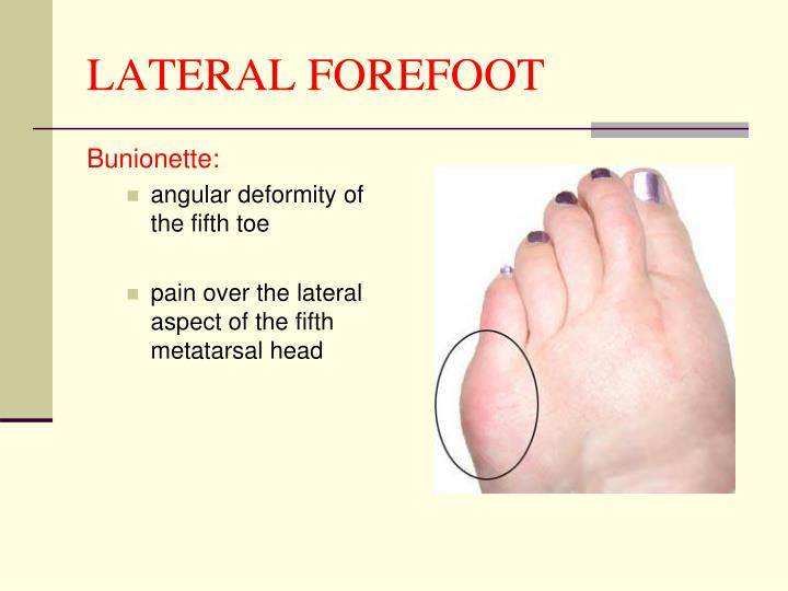 PPT - Foot and Ankle Pain PowerPoint Presentation - ID:5326379