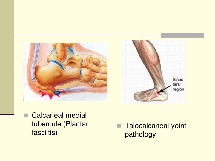PPT - Foot and Ankle Pain PowerPoint Presentation - ID:5326379