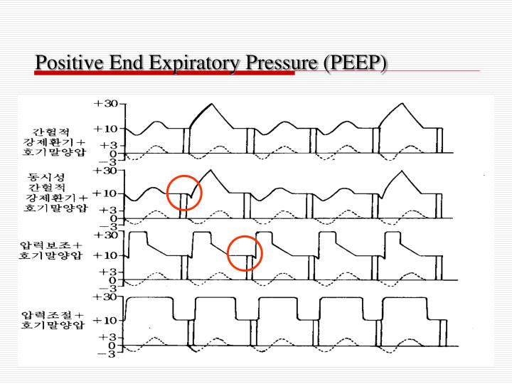 PPT - 기계적 환기 MECHANICAL VENTILATION PowerPoint Presentation - ID:5329430