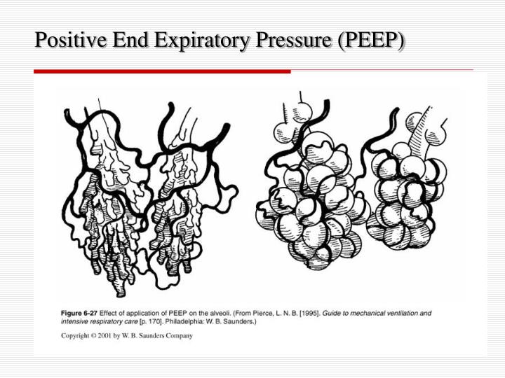 PPT - 기계적 환기 MECHANICAL VENTILATION PowerPoint Presentation - ID:5329430