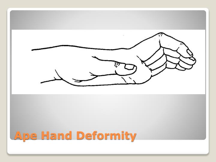 PPT - Hand PowerPoint Presentation - ID:5329847