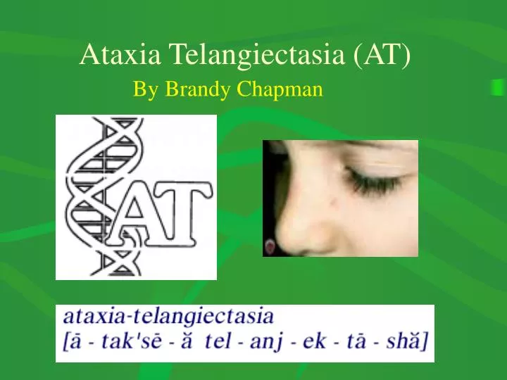 PPT - Ataxia Telangiectasia (AT) PowerPoint Presentation, free download ...