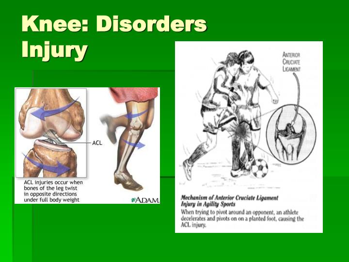 PPT - Knee Structure & Disorders PowerPoint Presentation - ID:5334265