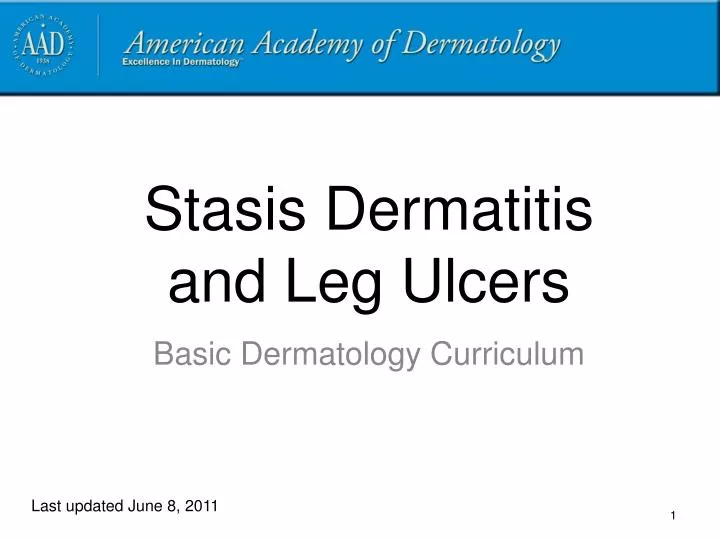 PPT - Stasis Dermatitis and Leg Ulcers PowerPoint Presentation, free ...