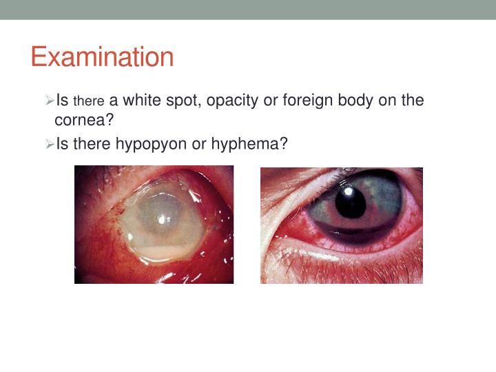 PPT - Red eye PowerPoint Presentation - ID:5338579