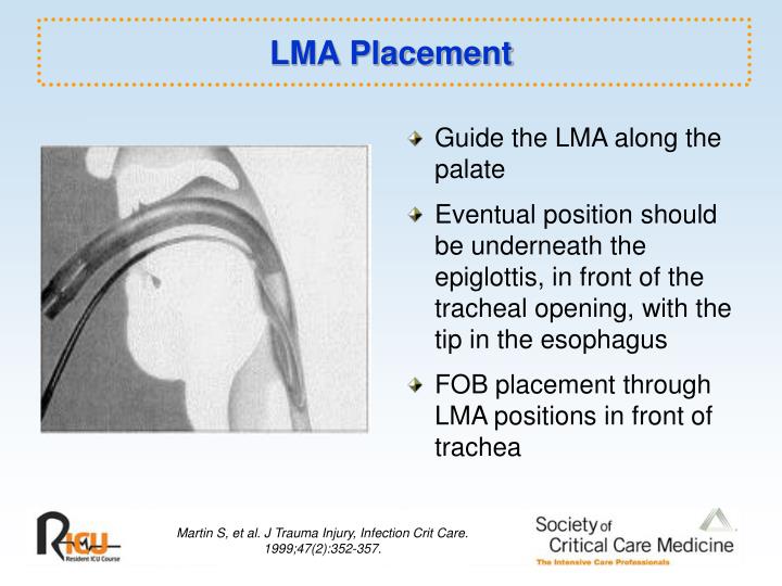 PPT - Airway Management in the Emergency Department and ICU PowerPoint ...