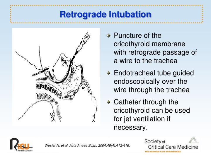 PPT - Airway Management in the Emergency Department and ICU PowerPoint ...