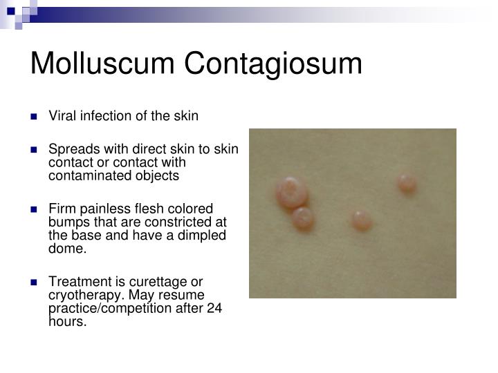 PPT - Contagious Skin Conditions PowerPoint Presentation - ID:5345657
