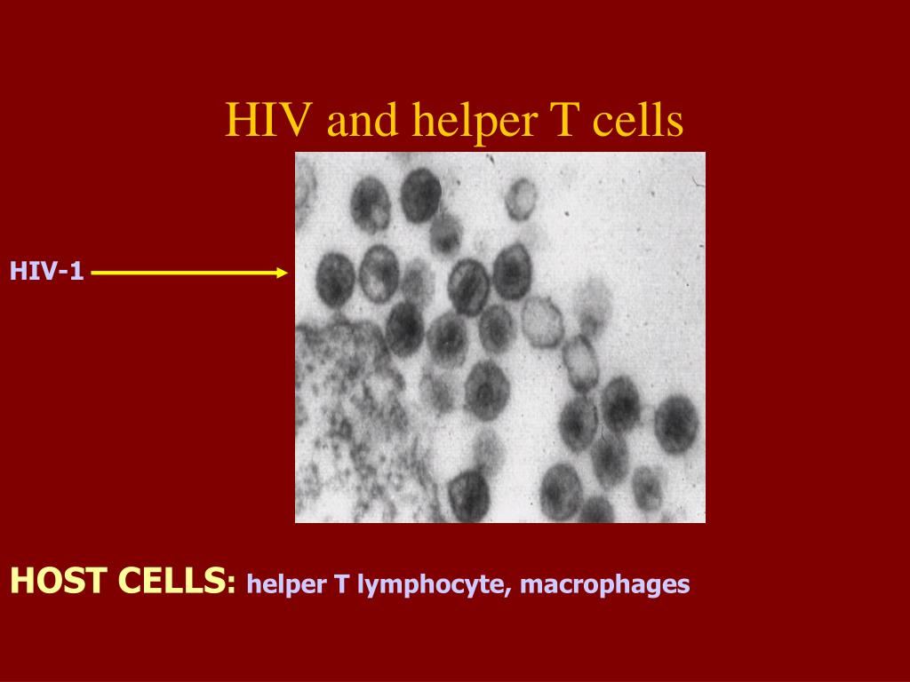 PPT - Virsuses: Human Immunodeficiency Syndrome & Acquired ...
