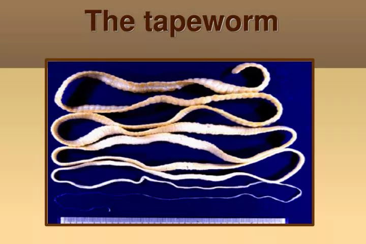 PPT - The tapeworm PowerPoint Presentation, free download - ID:5358896