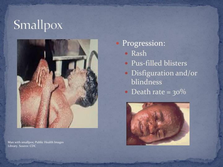 PPT - History of Infectious Disease PowerPoint Presentation - ID:5359429