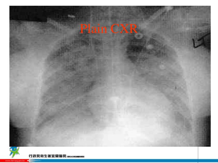 PPT - Prone position for Acute Respiratory Distress Syndrome PowerPoint ...