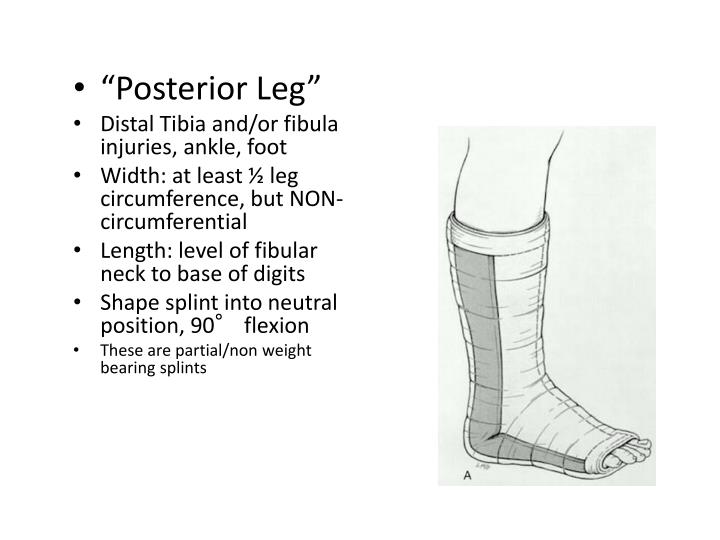 PPT - Splinting PowerPoint Presentation - ID:5364828