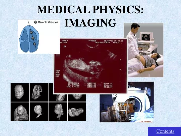 PPT - MEDICAL PHYSICS: IMAGING PowerPoint Presentation, free download ...