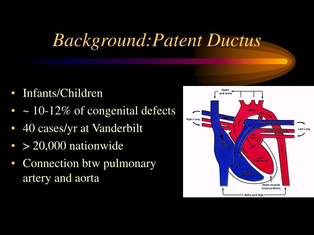Ppt Patent Ductus And Vascular Occlusion Devices Powerpoint