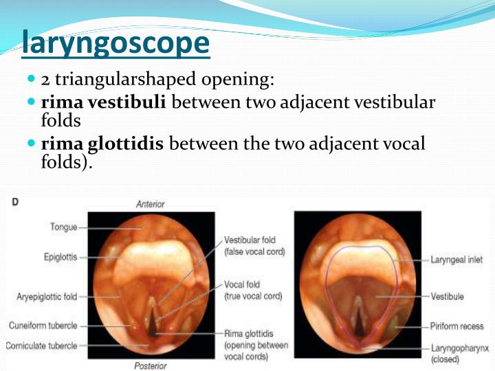 PPT - L arynx PowerPoint Presentation - ID:5370094