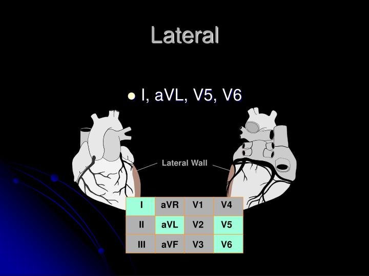 PPT - 12-Lead ECG Interpretation PowerPoint Presentation - ID:5370182