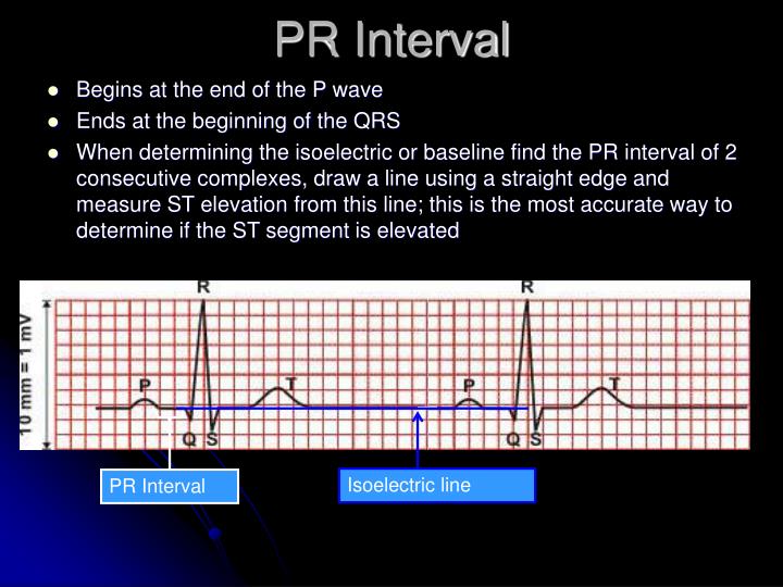 PPT - 12-Lead ECG Interpretation PowerPoint Presentation - ID:5370182