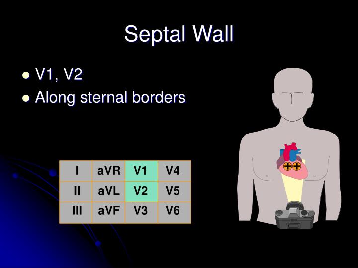 PPT - 12-Lead ECG Interpretation PowerPoint Presentation - ID:5370182