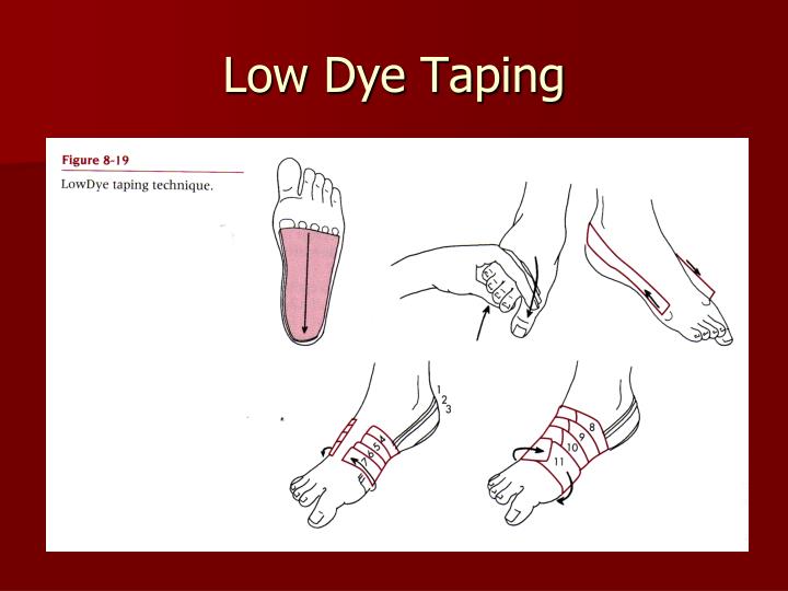 PPT - Chapter 8: Bandaging and Taping PowerPoint Presentation - ID:5371096