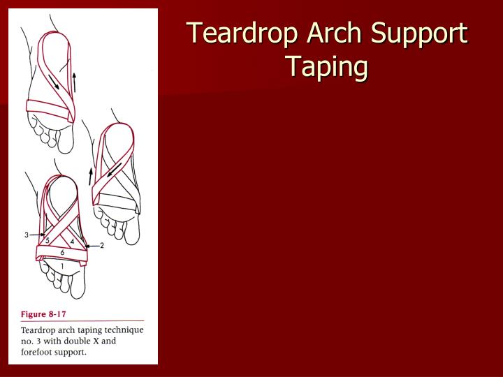 PPT - Chapter 8: Bandaging and Taping PowerPoint Presentation - ID:5371096