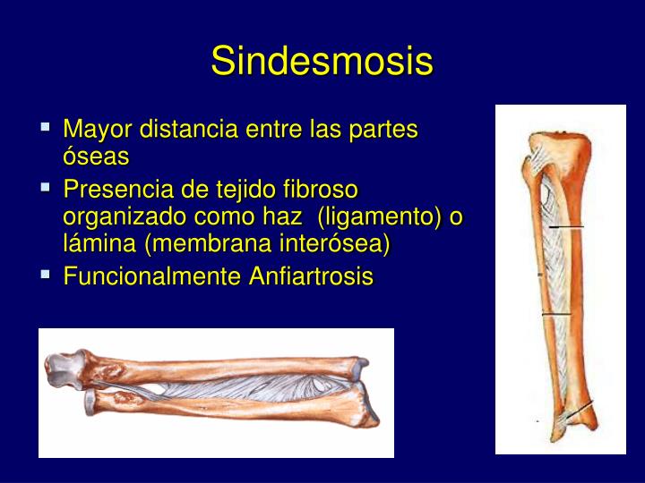 PPT - Sistema Articular PowerPoint Presentation - ID:5371784